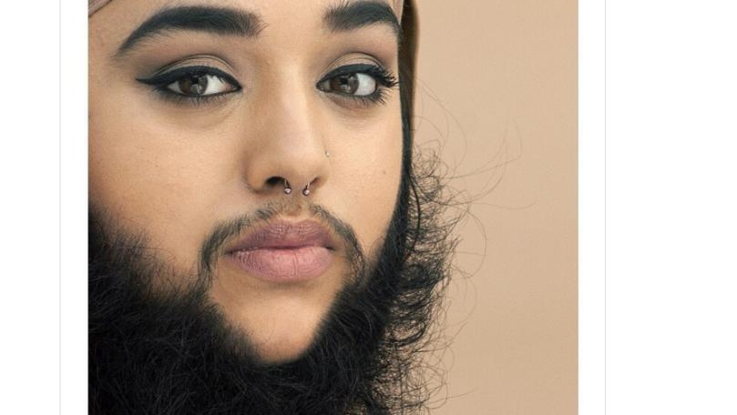 Photos: Women With Excessive Facial Hair Share Their Stories - MTV Lebanon